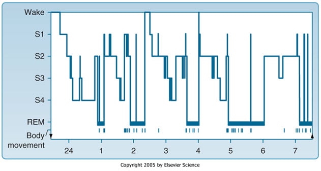 Nonrestorative Sleep in Fibromyalgia Syndrome: From Assessment to Therapy