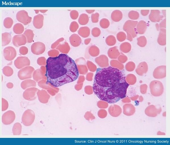 Acute Promyelocytic Leukemia: For Oncology Nurses