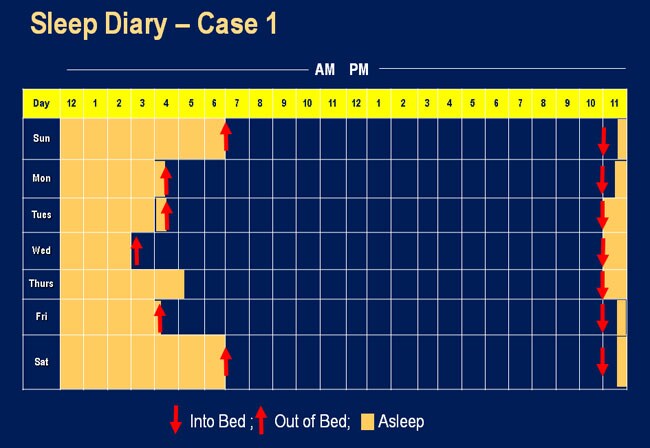 Shift Work and Sleep: Health, Safety, and Performance