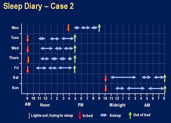 Shift Work and Sleep: Health, Safety, and Performance