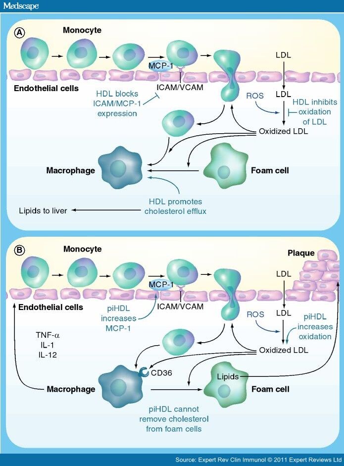 Systemic Lupus Erythematosus and Cardiovascular Disease - Page 4
