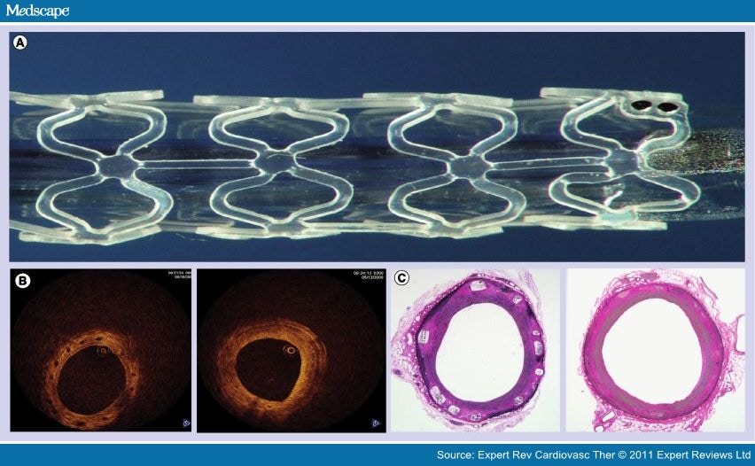 Current and Future Drug-Eluting Coronary Stent Technology - Page 7
