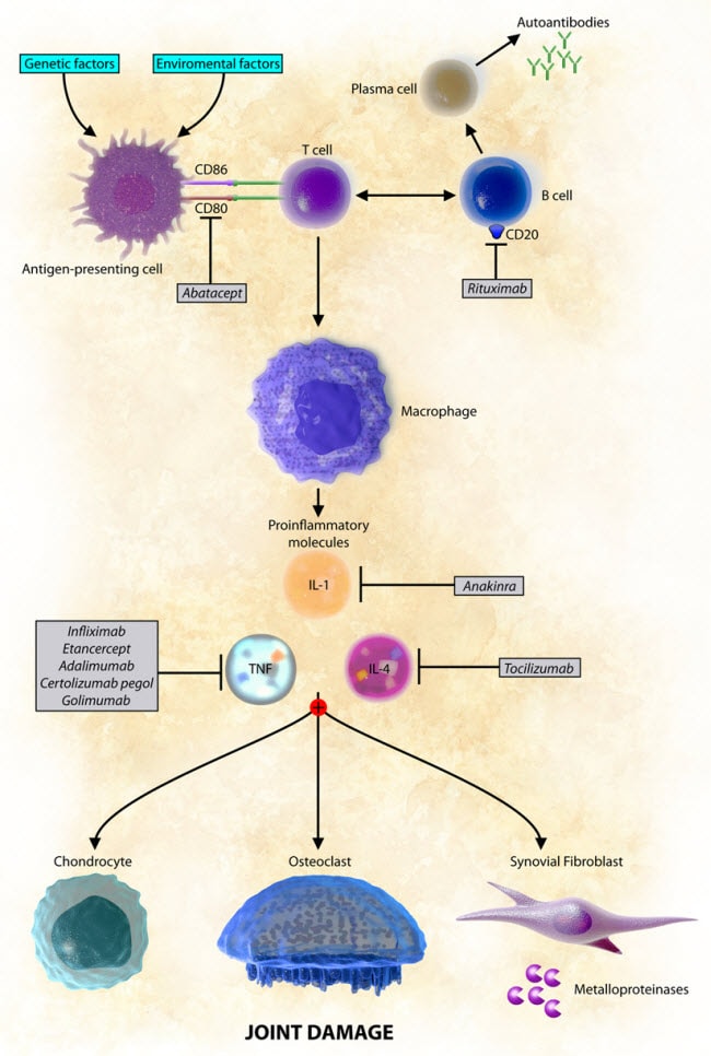 Rheumatoid Arthritis: A Practical Guide for the Primary Care Provider