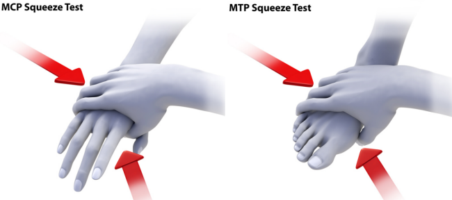 Rheumatoid Arthritis: A Practical Guide for the Primary Care Provider