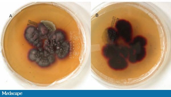 Rings Around an Infection - Page 2