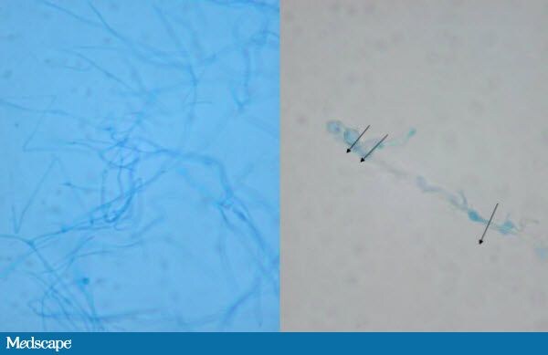 Rings Around an Infection - Page 2