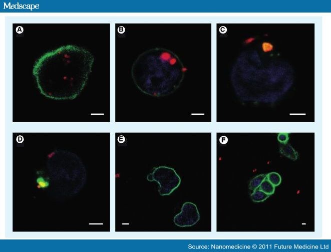 Quantum Dots and Carbon Nanotubes in Oncology