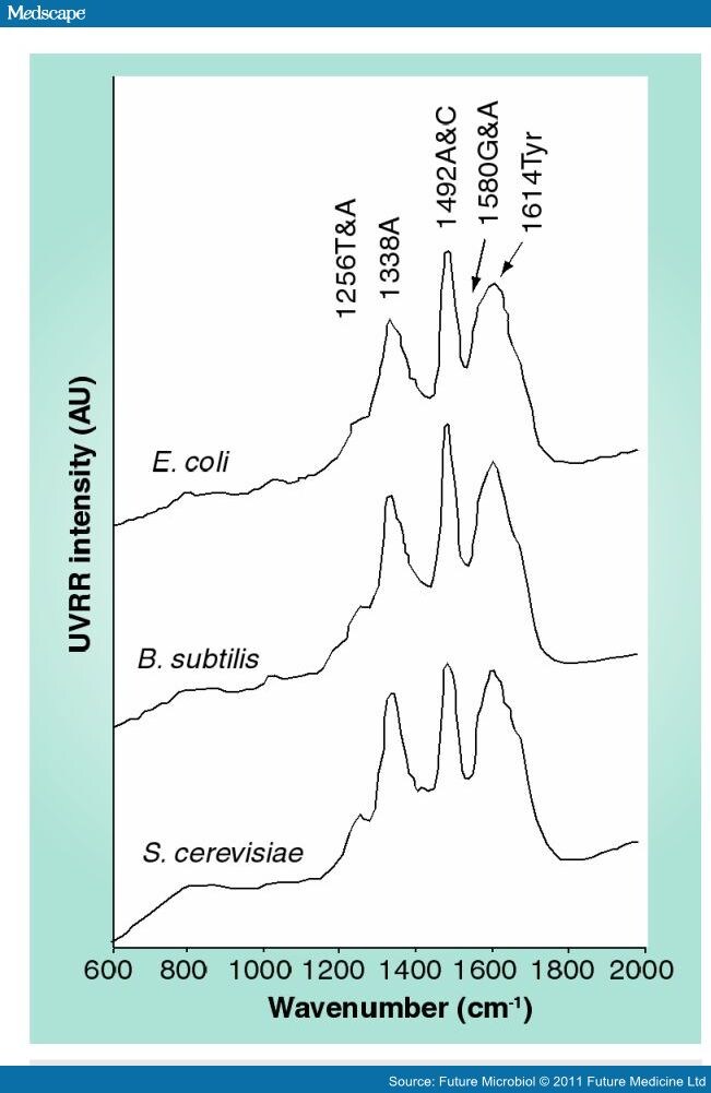Raman Spectroscopy: The Future of Microbial Identification