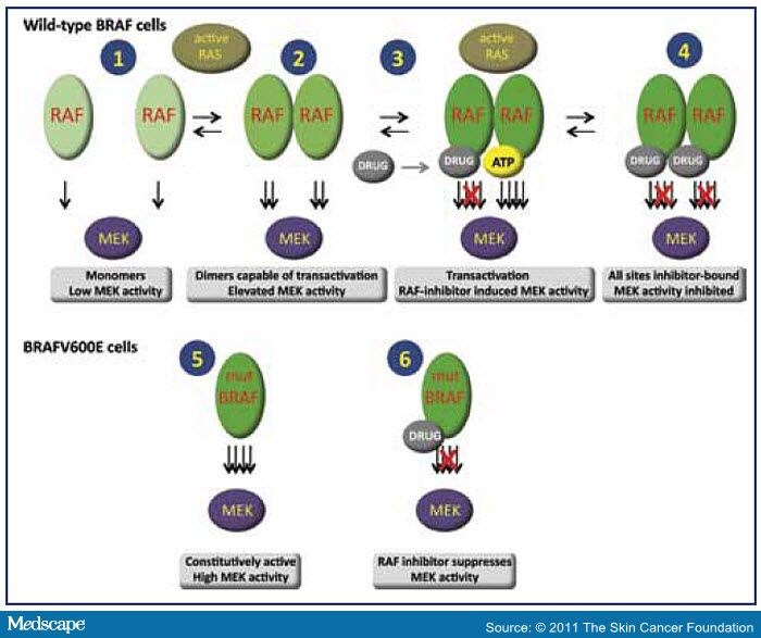 How Zelboraf Extends Life for Patients With Metastatic Melanoma - Page 2
