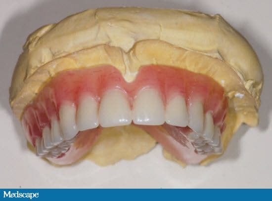 One-Hour Complete Dentures - Page 3