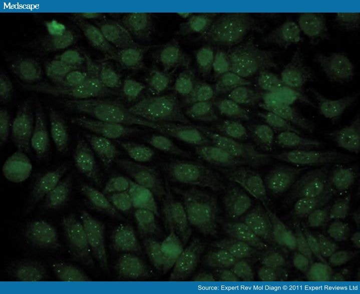 Antinuclear Antibodies as Markers in Biliary Cirrhosis - Page 2