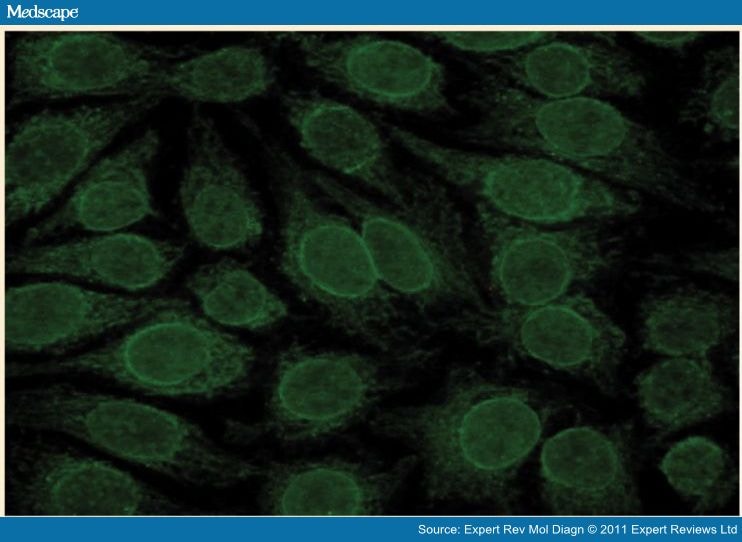 Antinuclear Antibodies as Markers in Biliary Cirrhosis - Page 2