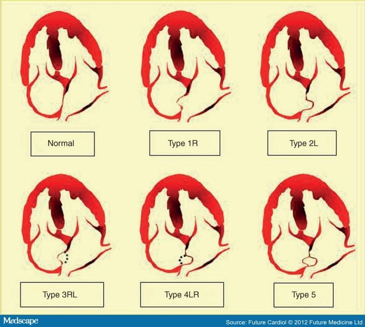 Echocardiography in the Management of Sources of Embolism - Page 5