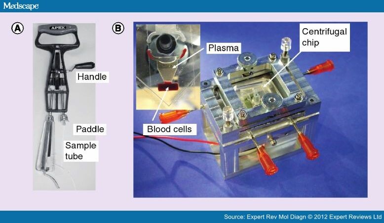 Chip-compatible Samples for Diagnosis of Infectious Diseases - Page 7