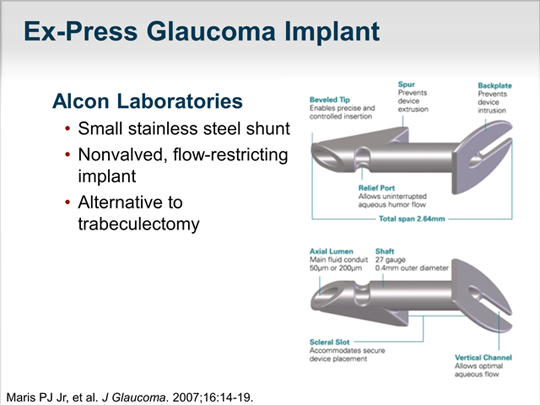 Trabeculectomy Express Shunt