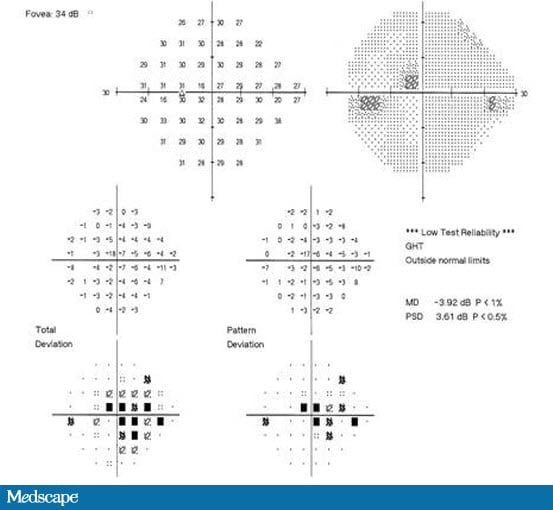 A Woman With Transient Visual Loss - Page 2