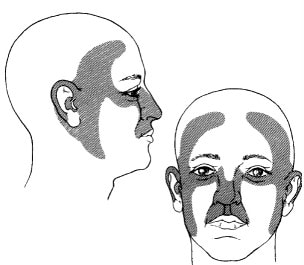 Incorporating Treatment Advances for Basal Cell Carcinoma Into Clinical ...