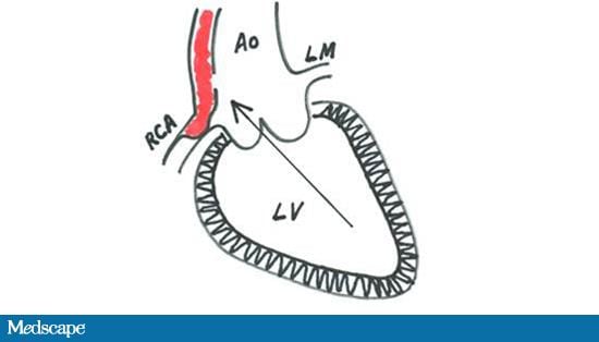 A Case of Suspected Aortic Dissection - Page 2