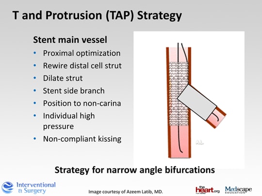 Bifurcation Stenting in a Patient With Prior CABG (Transcript)