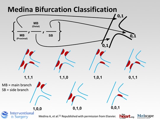 An Elderly Man With AF and a Bifurcation Lesion (Transcript)