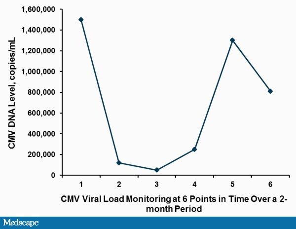 Prevention and Treatment of Cytomegalovirus Infection in Solid Organ ...