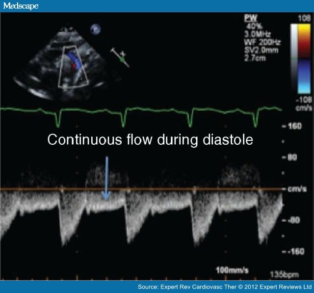Imaging of Aortic Arch Anomalies and Associated Findings - Page 3
