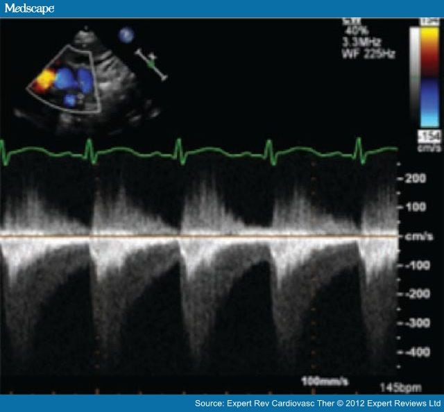 Imaging of Aortic Arch Anomalies and Associated Findings - Page 3