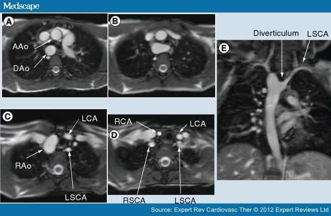 Imaging of Aortic Arch Anomalies and Associated Findings - Page 3