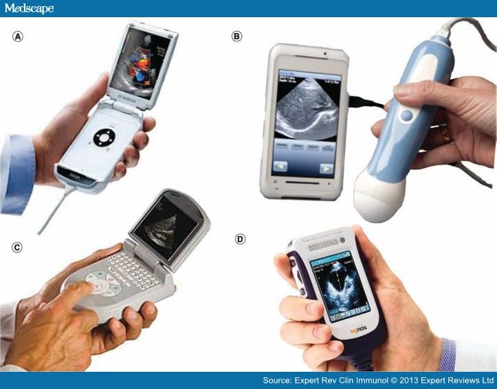 Clinical Implementation of Hand-held Echocardiography - Page 2