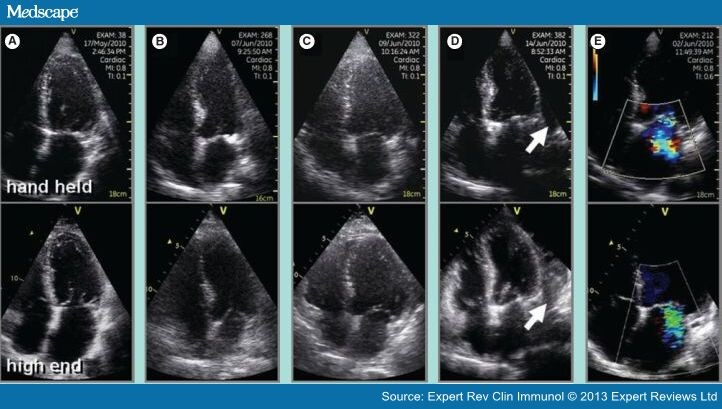 Clinical Implementation of Hand-held Echocardiography - Page 3