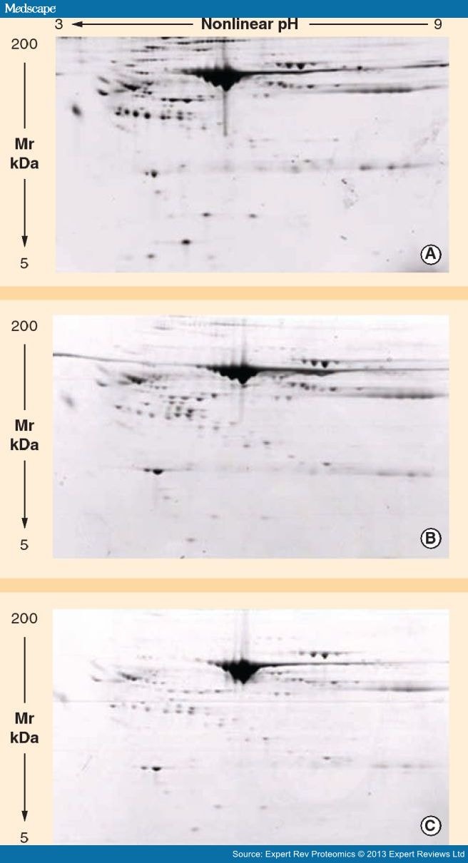 An Overview of Staining Methods for In-Gel Proteomics - Page 4