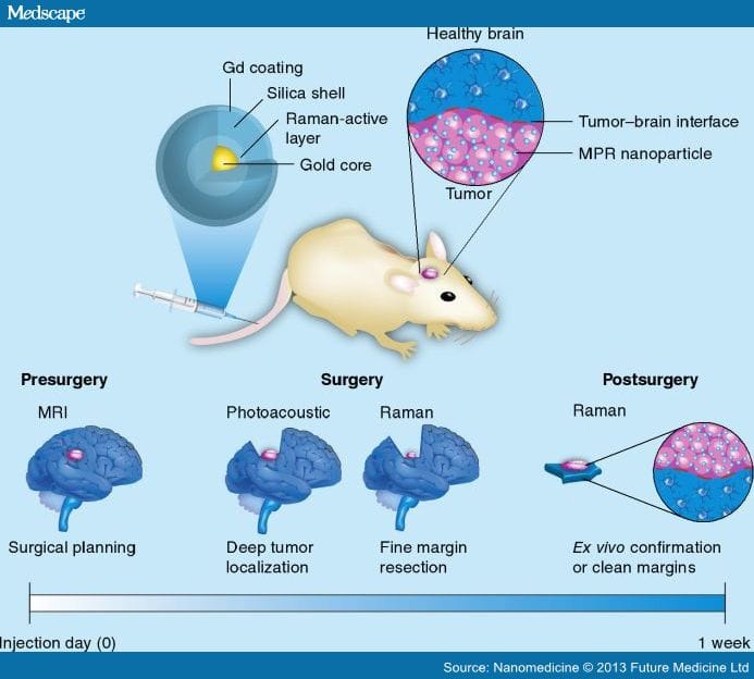 Nanoparticles for Imaging and Treating Brain Cancer - Page 8