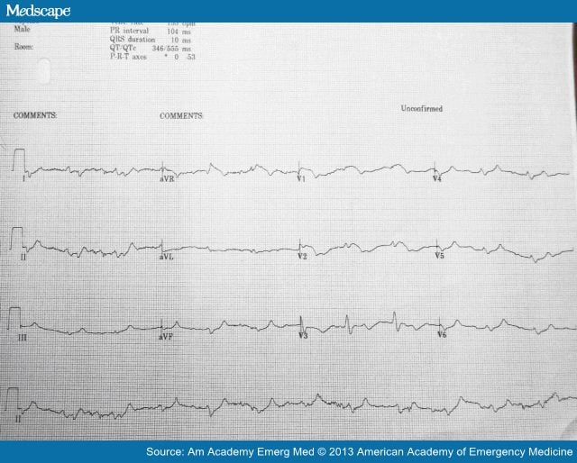 Image of the Month: Critical EKG Findings Not to Miss