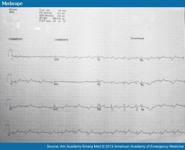 Image of the Month: Critical EKG Findings Not to Miss
