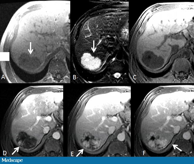 Understanding Gadolinium-Based Contrast Agents: From the Molecule Up