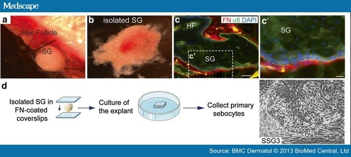 Regulation of Lipogenesis in Human Sebaceous Glands Cells - Page 3