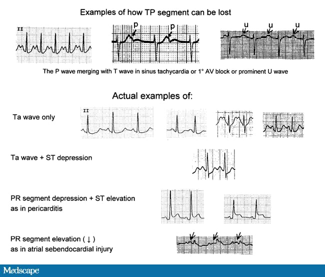 Which Would You Choose? - Page 2