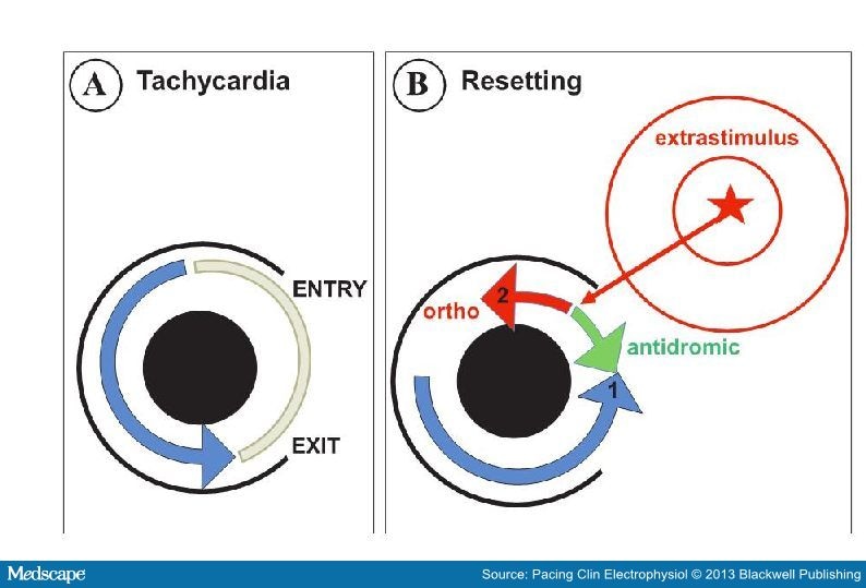 Resetting and Entrainment of Reentrant Arrhythmias: Part I - Page 3