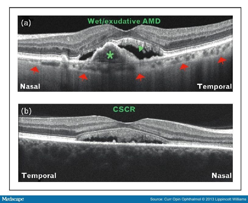 OCT: Current and Future Applications