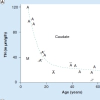 The Genetics of Segawa Disease