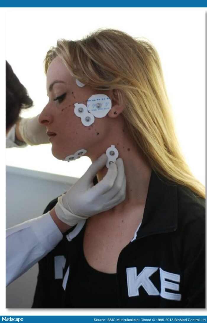 Comparison of Sensory and Motor TENS in Patients with TMD - Page 3