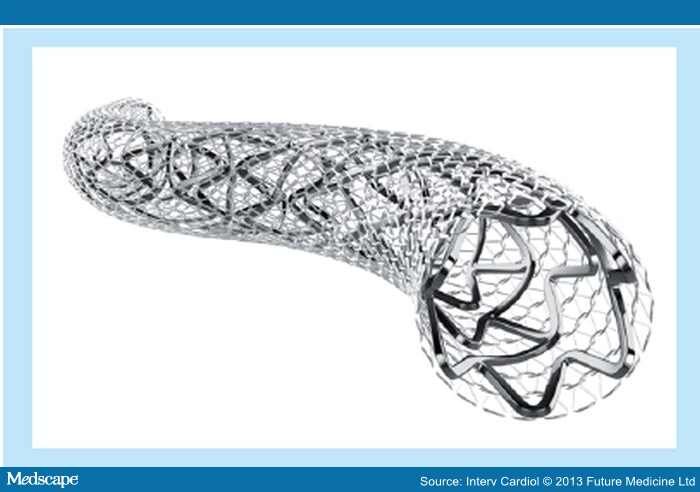 Primary Percutaneous Coronary Intervention - Page 5
