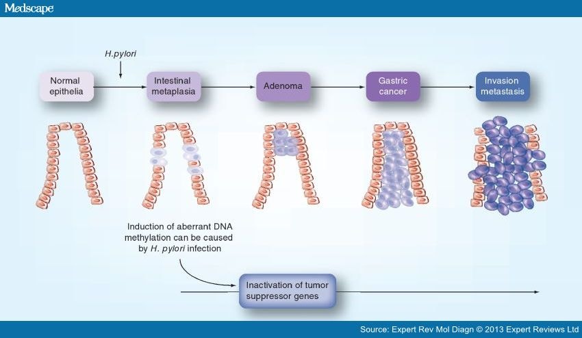 Tumor Suppressor Genes as Biomarkers in Gastric Cancer - Page 6