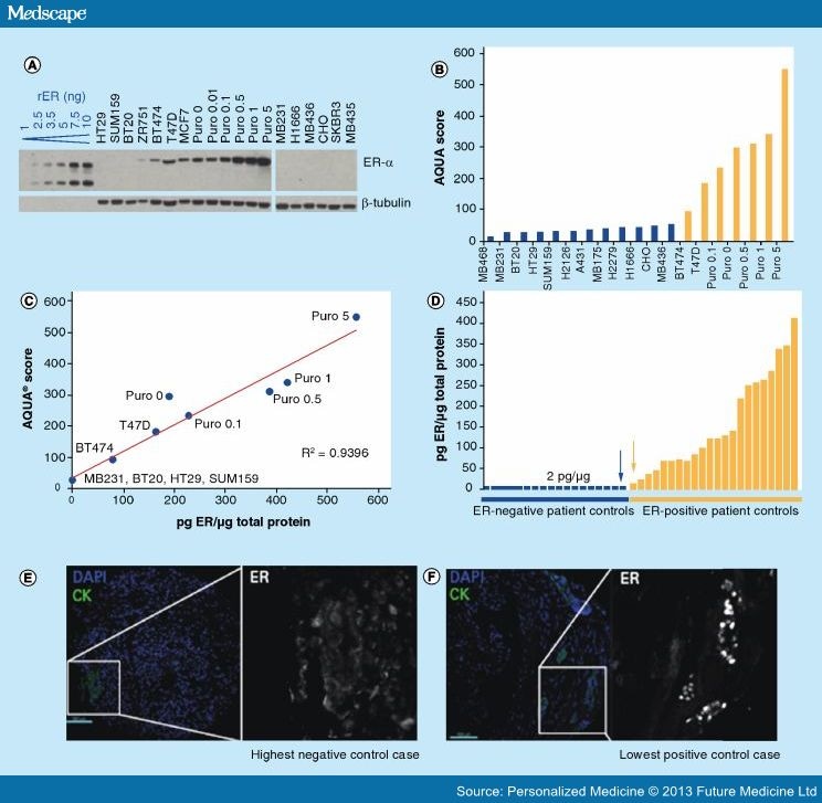Tissue Microarrays