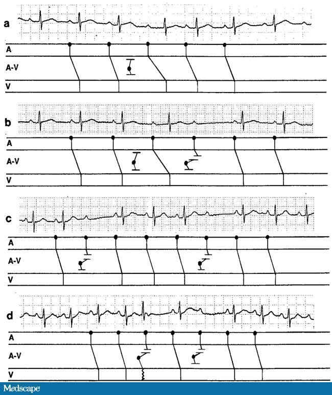 What Is Happening in This Tracing? - Page 2