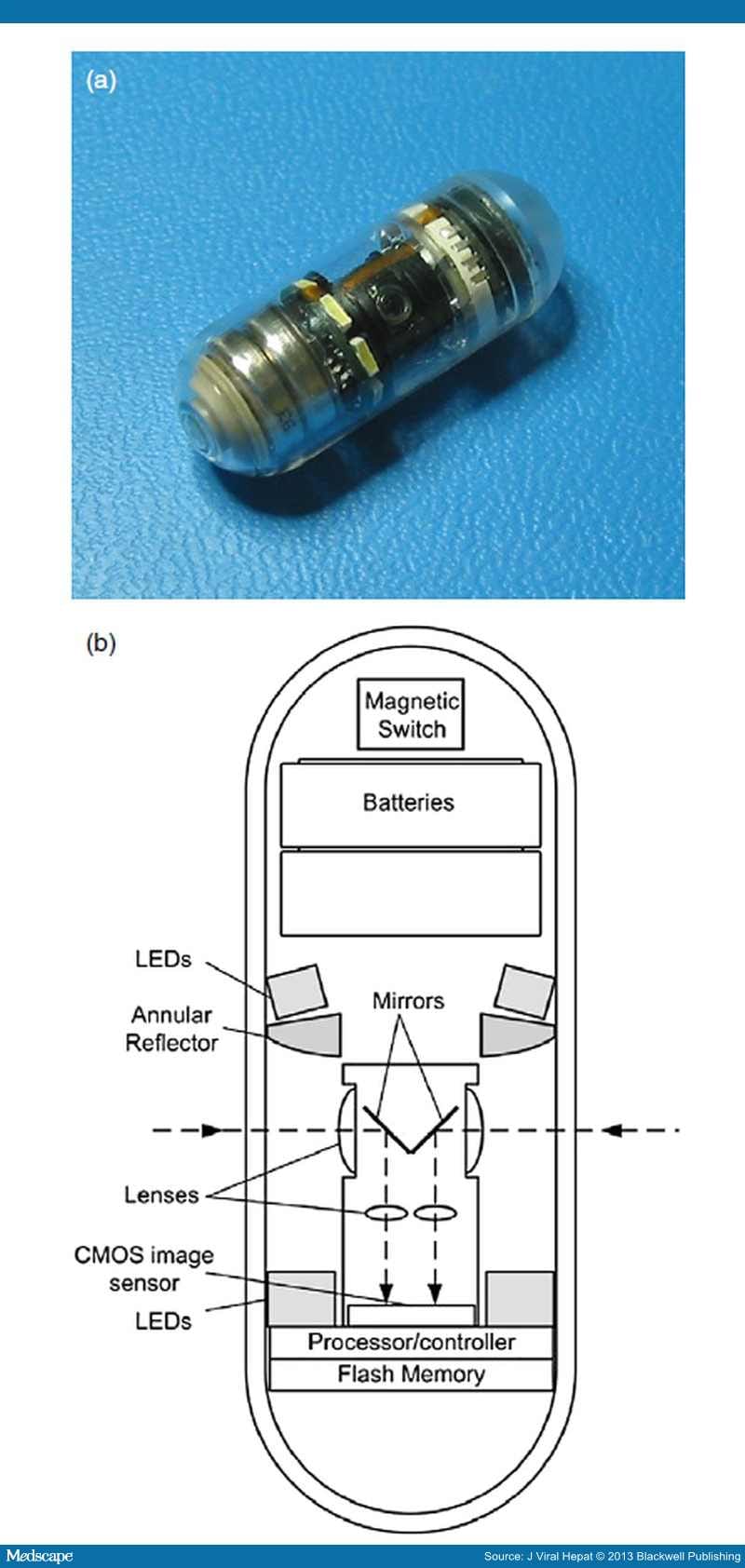 Capsule Endoscope With Side View for Small Bowel