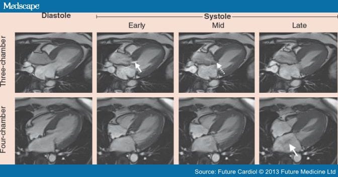 Advances of Cardiovascular MRI in Hypertrophic Cardiomyopathy - Page 4