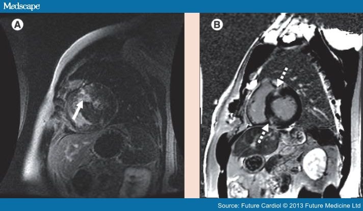 Advances of Cardiovascular MRI in Hypertrophic Cardiomyopathy - Page 4