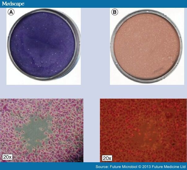 Plaque Assay for Testing the Antibiotic Susceptibility - Page 2