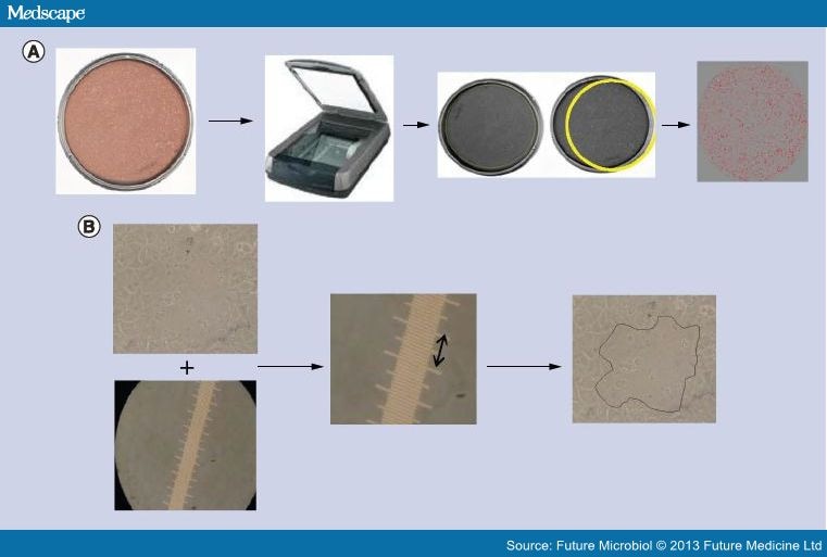 Plaque Assay for Testing the Antibiotic Susceptibility - Page 6